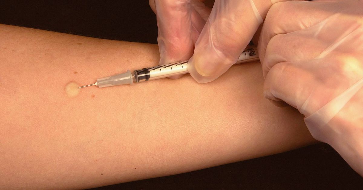 Tuberculosis Tests (TB Tests) - Shoebill Co-Traveller | Shoebill Health ...